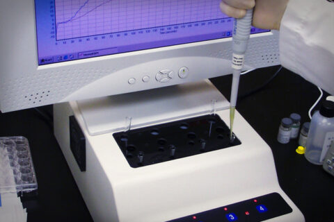 Platelet Aggregation | Helena Laboratories – Innovations for Science ...