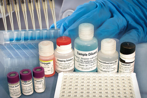 ELISA Assays | Helena Laboratories – Innovations for Science & Clinical ...