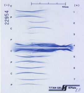 TITAN Gel Proteins | Helena Laboratories – Innovations for Science ...